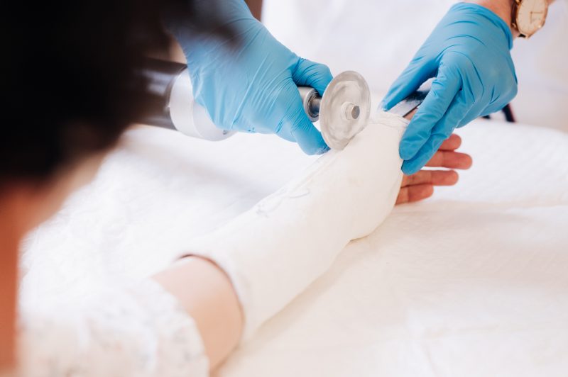 Gips. Czy warto go stosować? - Fizjologika